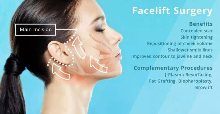 Facelift Surgery in Turkey - MCT : Medical Center Turkey