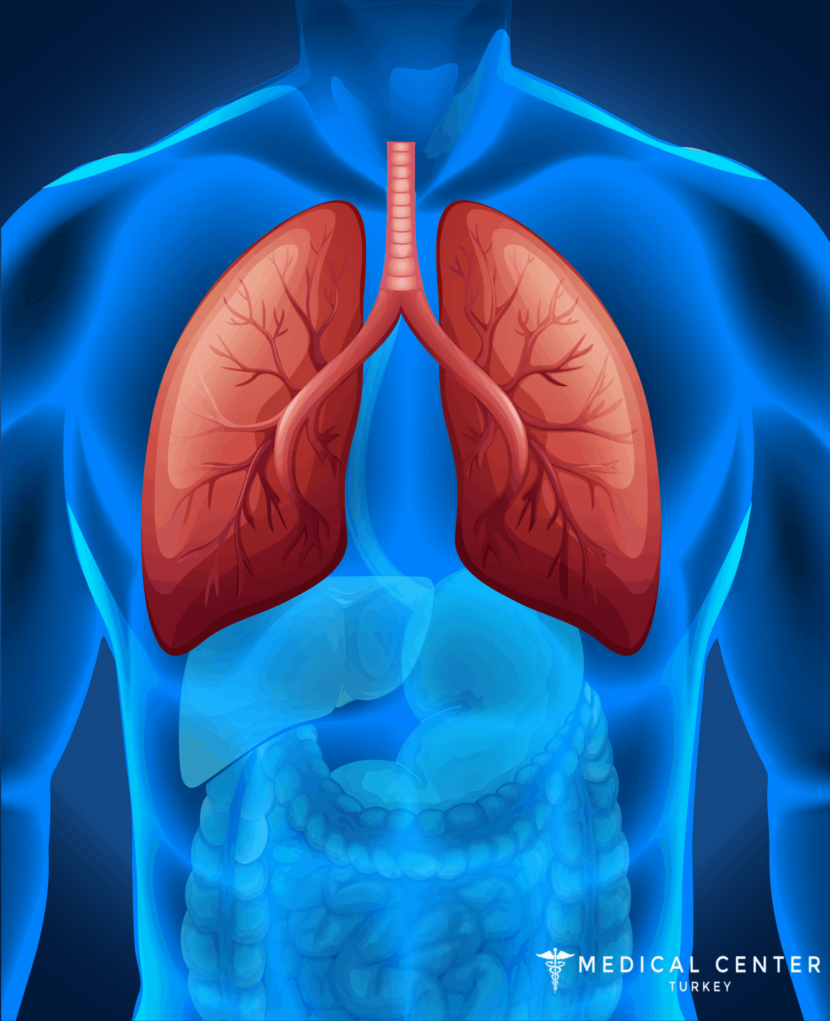 Lung Cancer Treatment in Turkey - Medical Center Turkey