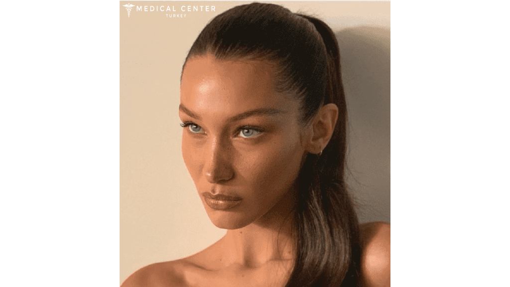 10 Most Popular Aesthetic Operations In Turkey -MCT