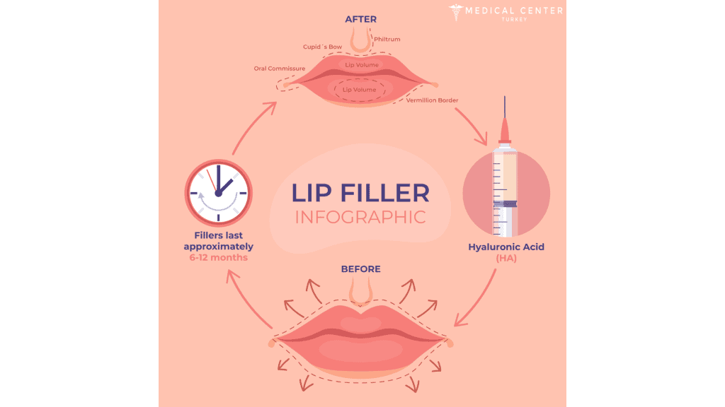 Lip Fillers vs Lip Lift - Medical Center Turkey