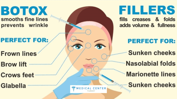 Botox Prices In Turkey - Medical Center Turkey