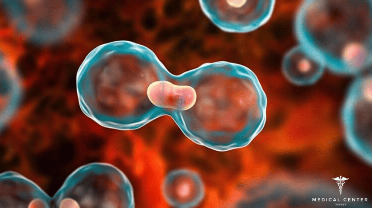 How Successful is Leukemia Treatment - MCT