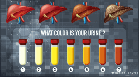 Liver Disease - Medical Center Turkey