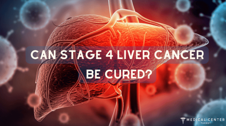 Can stage 4 liver cancer be cured? - MCT