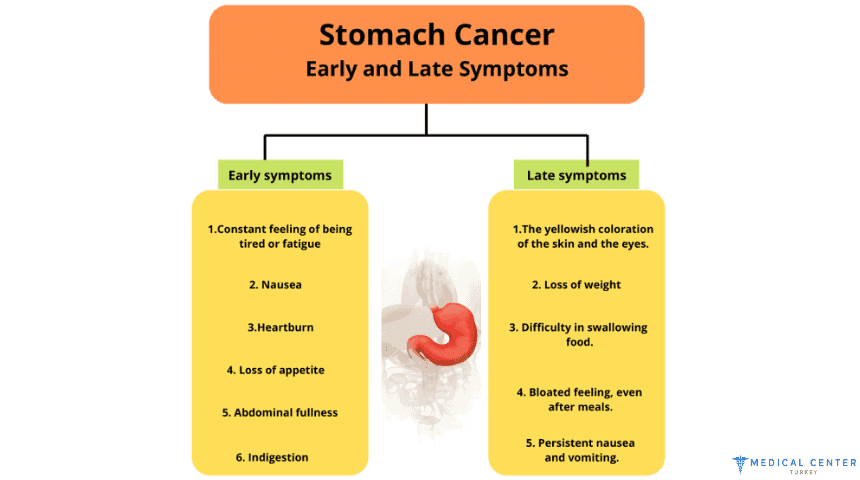 Stomach (Gastric) Cancer - MCT