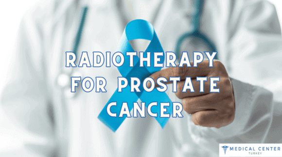 Radiotherapy for Prostate Cancer - MCT