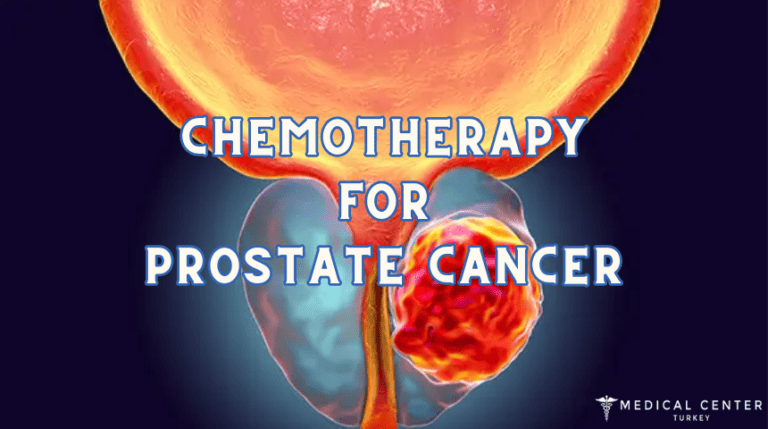 Chemotherapy for Prostate Cancer - MCT