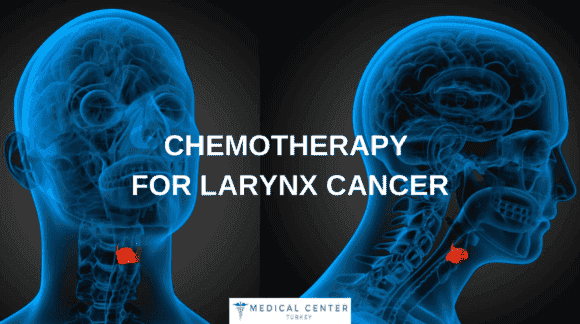 Chemotherapy for Larynx Cancer - MCT