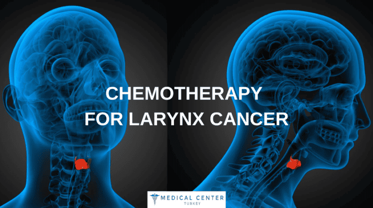 Chemotherapy for Larynx Cancer - MCT
