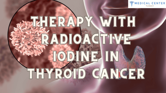 Therapy with Radioactive Iodine in Thyroid Cancer - MCT