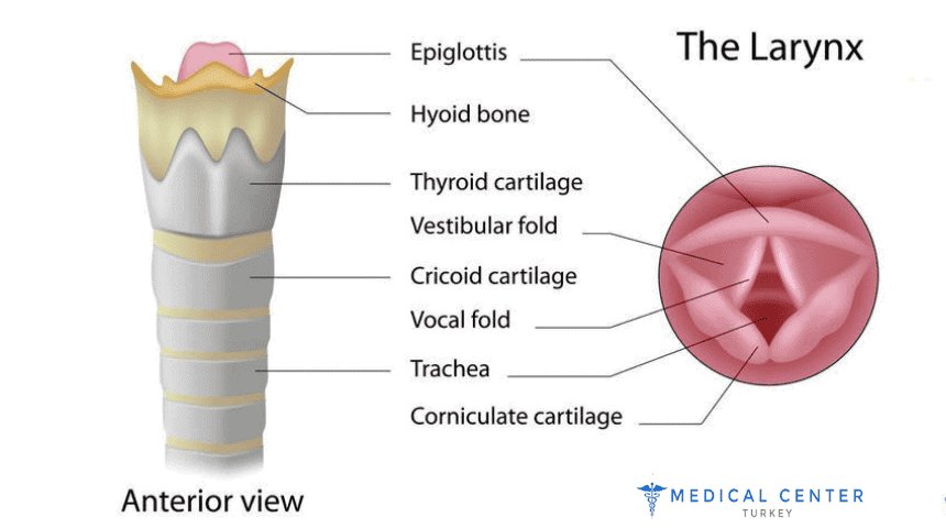 Throat Cancer Operation - MCT
