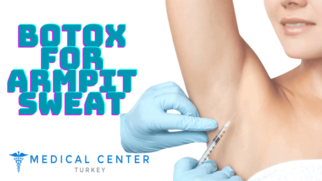 Botox for Armpit Sweat - MCT