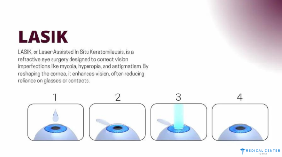 Types of Eye Operations in Turkey - Medical Center Turkey