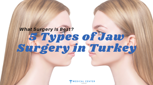 What Surgery is Best? 5 Types of Jaw Surgery in Turkey - Medical Center ...