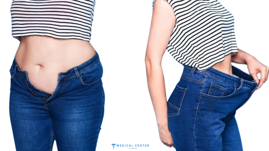 Laser Lipo vs. Vaser Lipo: Which is Better? - Medical Center Turkey