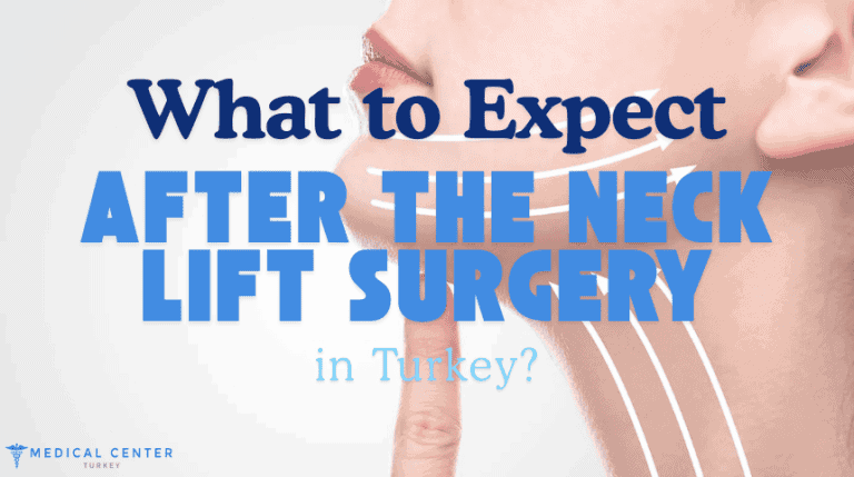 What to Expect After the Neck Lift Surgery in Turkey? - Medical Center ...