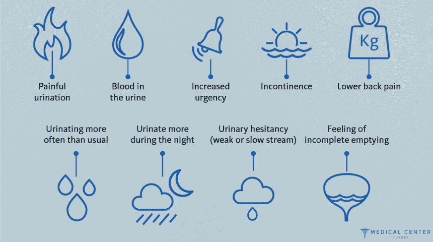 Bladder Cancer in Turkey - MCT