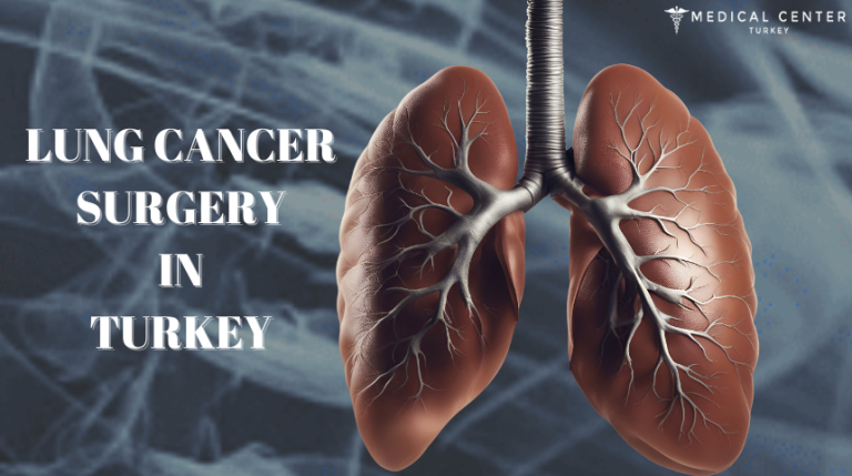 Lung Cancer Surgery in Turkey - MCT